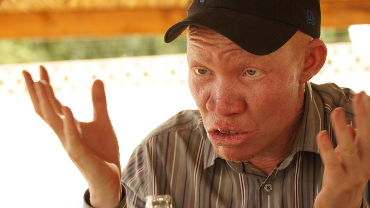 ‘Ghosts’: Albino Africans discriminated against due to colour of their ...